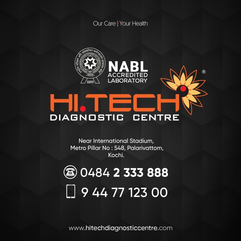 Best Labs in Kochi: Why Hi-Tech Diagnostic Centre Stands Out